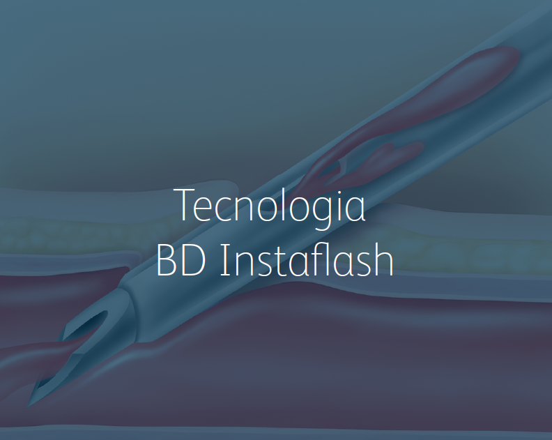 Tecnologia diferencial BD