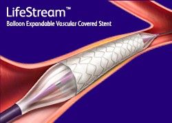 BD Peripheral Arterial Disease Portfolio