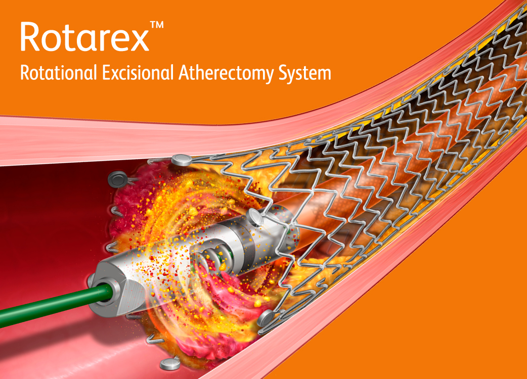 BD Peripheral Arterial Disease Portfolio
