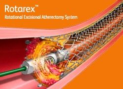 BD Peripheral Arterial Disease Portfolio